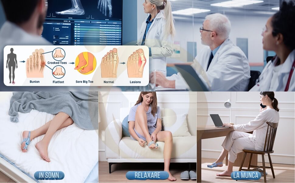 Corector Monturi de Zi si Noapte pentru picioare, Hallux Valgus, Cu ...