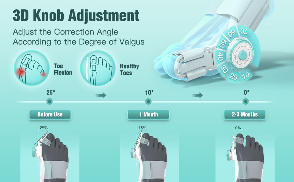 Corector Ortopedic Monturi, cu Atela reglabila, pentru Ameliorarea ...